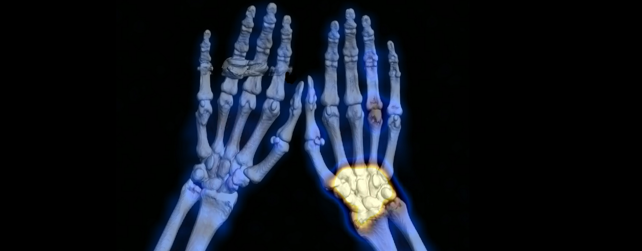 Examen Scintigraphie