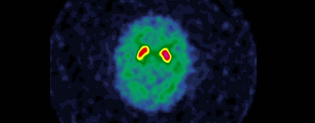 Examen Scintigraphie